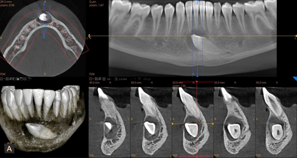 Diagnostyka RTG – CBCT 3D (Carestream CS 9600) - Gabinety ...